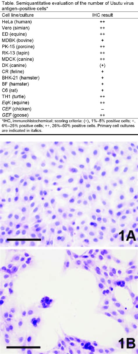 Cytopathic Effect Cpe Of Vero Cells Caused By Usutu Virus Infection