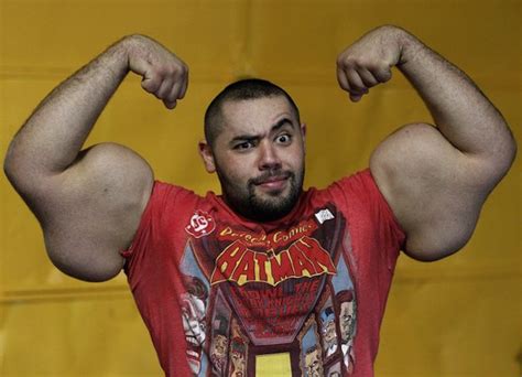 What Is Synthol And Why Are Guys Using It