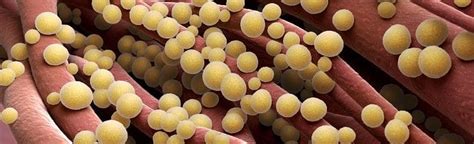 Staphylocoque Capitis Symptômes Traitements Et Prévention Des Infections Du Cuir Chevelu