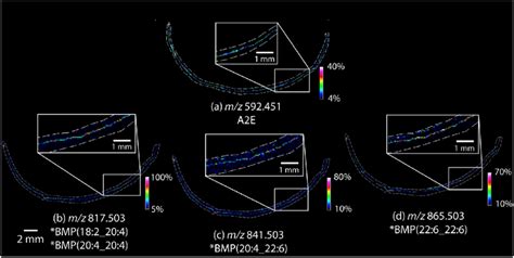 Maldi Ims Analysis Of 82 Year Old Human Retina Tissue A Maldi Ims