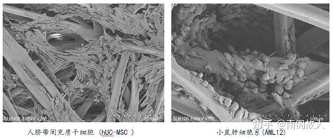 [组织修复]：基于gelma 壳聚糖微球的3d生物打印多尺度复合支架增强3d神经生长 知乎