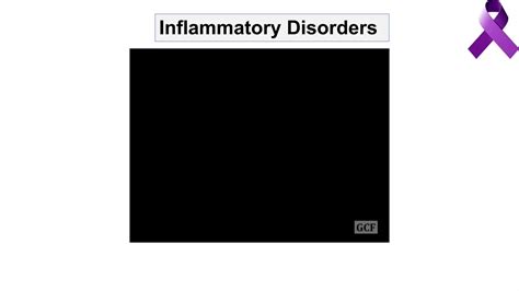 Ulcerative Colitis Complications Management Pptx