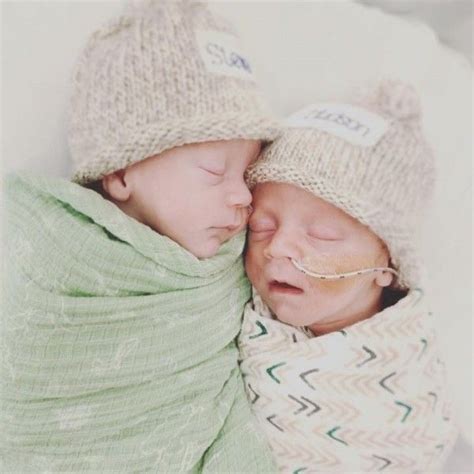 Pin On Stories About Twin Anemia Polycythemia Sequence