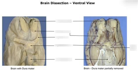 Brain Ventral View Diagram Quizlet