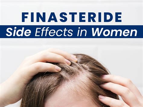 Finasteride Side Effects In Women What Studies Say Estenove