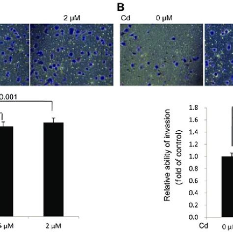 Effects Of Cd Treatment On A549 Cell Migration And Invasion A