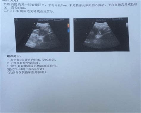 河池试管婴儿医院排名一览，2025助孕机构优选攻略天翔助孕机构