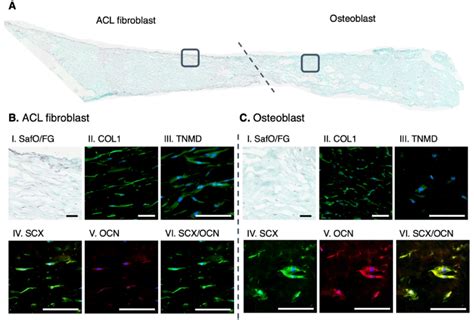 Two Zone Acl Fibroblast Spinal Osteoblast Seeded Adcs After 14 Day