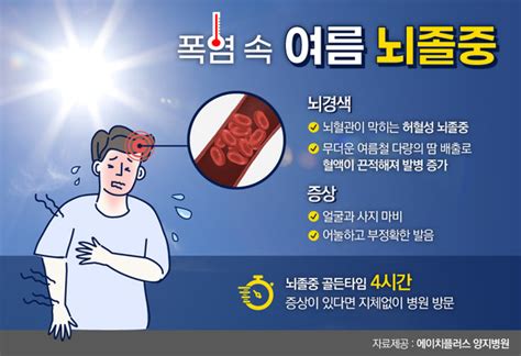 폭염 속 여름 뇌졸중 주의환절기 뇌출혈 여름은 뇌경색 위험성 높아