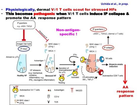 Alopecia Areata Autoimmune Disease Or Hair Follicle Response Pattern