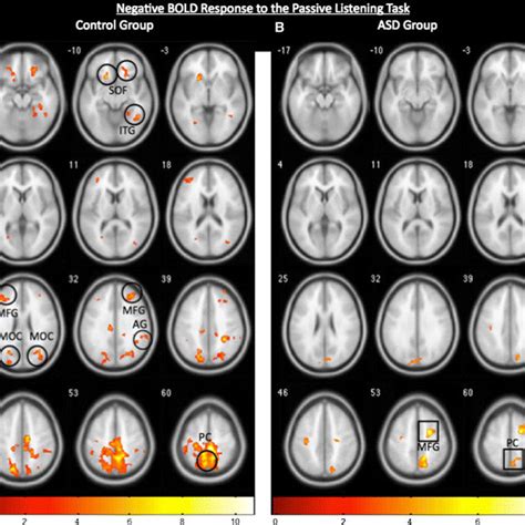 Positive Bold Related Fmri Activity Associated With The Control Group