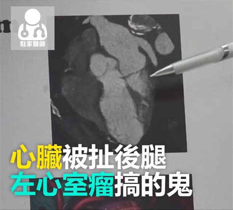 心臟血管中心 活動花絮 臺中榮總全球資訊網 Taichung Veterans General Hospital