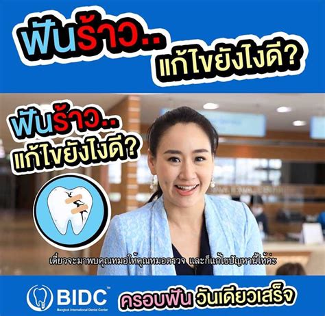 ครอบฟัน อยู่ได้นานขนาดไหน หลังครอบแล้วดูแลยังไง Bidc Dental