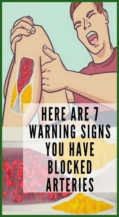 Here Are 7 Warning Signs You Have Blocked Arteries Tanjasita Artofit