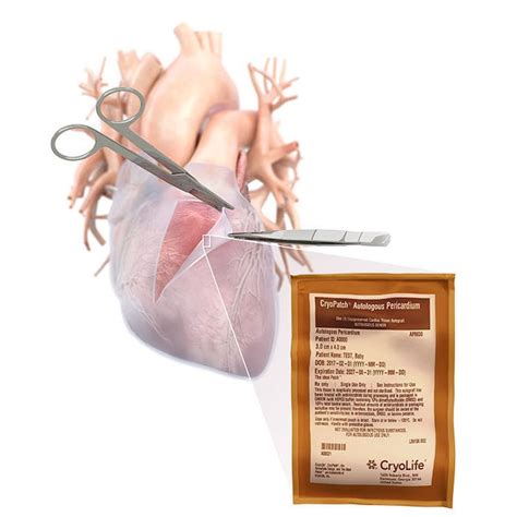 Cardiac Tissue Matrix Cryopatch Cryolife Allograft