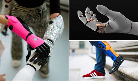 Las Prótesis Impresas En 3d Ayudar Gracias A Las Nuevas Tecnologías