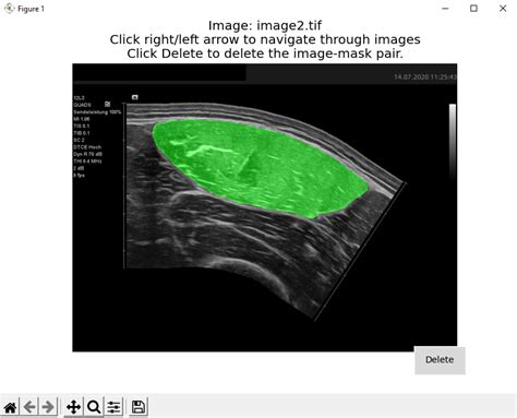 Usage Deepacsa 031 Documentation