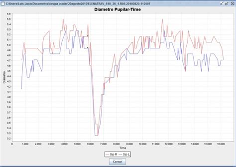 Pupillometry Menu Generated By Cabanillas Software Data From A