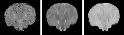Figure 1 From Automatic Segmentation Of Neonatal Brain Semantic Scholar