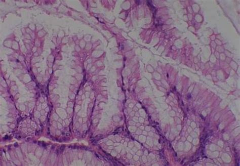 Novus Biologicals™ Human Ovary Tissue Microarray Cancer Slide Human