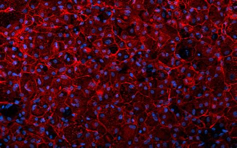 Gene Editing Cures Hereditary Liver Disease In Finland Helsinki Times
