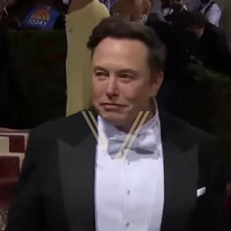 Elon Musk Hair Transplant Before And After