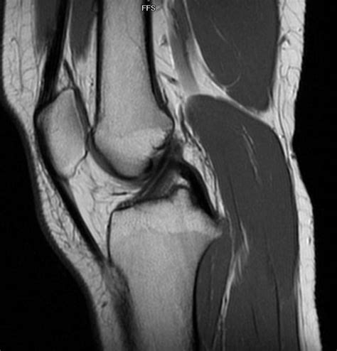 Lower Extremities Diagram Quizlet