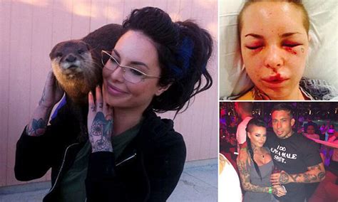 Christy Mack Recovery