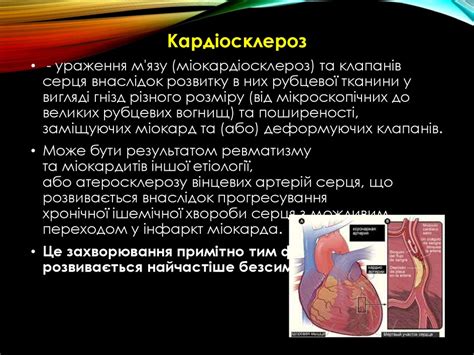 Ішемічна хвороба серця презентация онлайн