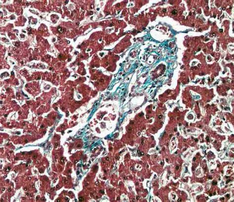 Fibrin Weigert Stain Method
