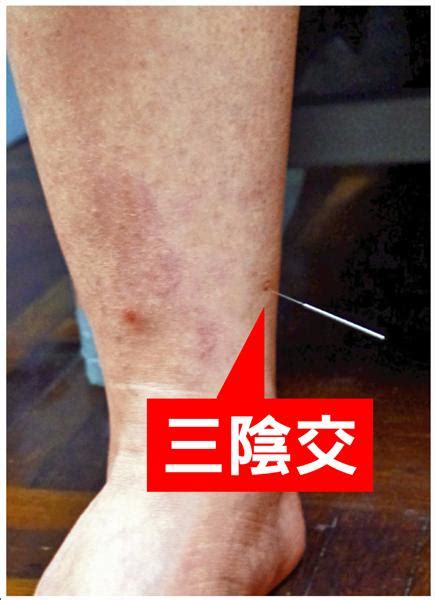 考前焦慮 中醫對症紓壓 自由健康網