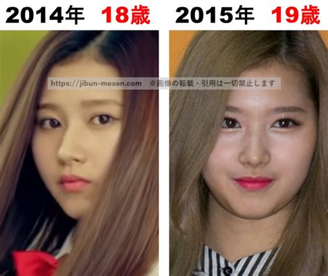 【画像40枚】twiceサナの整形費用はたったの23万円？2020年までに小鼻縮小術で整形済？顔の変化を無加工写真で徹底検証！ 自分目線