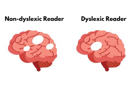A Guide To Understanding Dyslexia And The Dyslexic Brain My Take On