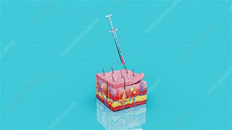 Injection Illustration Stock Image F0422308 Science Photo Library
