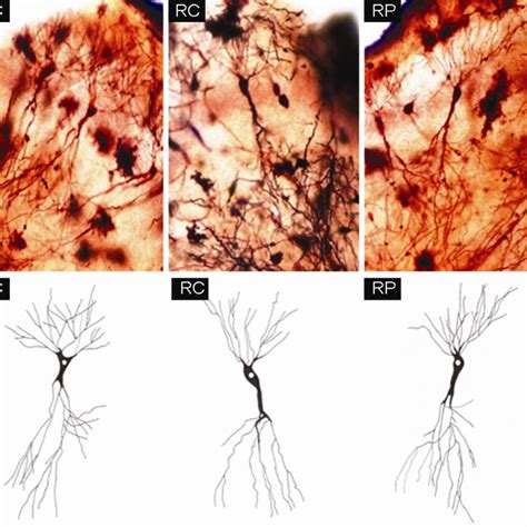Representative Photomicrographs Of Golgi Stained CA3 Pyramidal Neurons