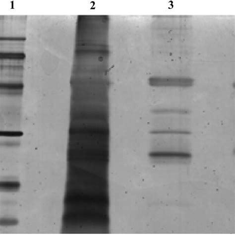 Silver Staining Sds Page From Tobacco Proteins Purified With Download Scientific Diagram