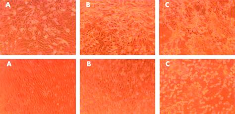 Doxycycline—a Role In Ocular Surface Repair British Journal Of Ophthalmology