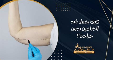 كيف يعمل شد الذراعين بدون جراحة؟ د علي جابر