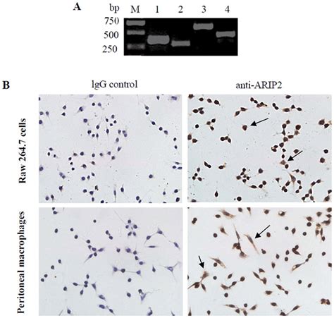 Expression Of Arip2 In Mouse Macrophages A Expressions Of Arip2 Download Scientific Diagram