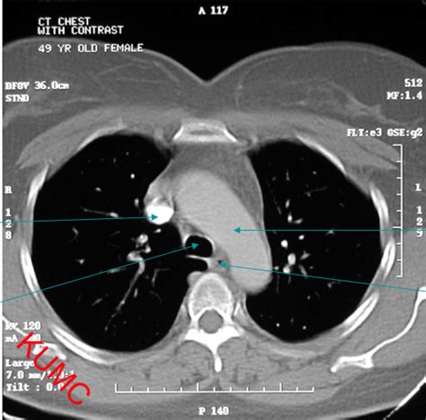 Diagrama De Ct Scan Chest Quizlet