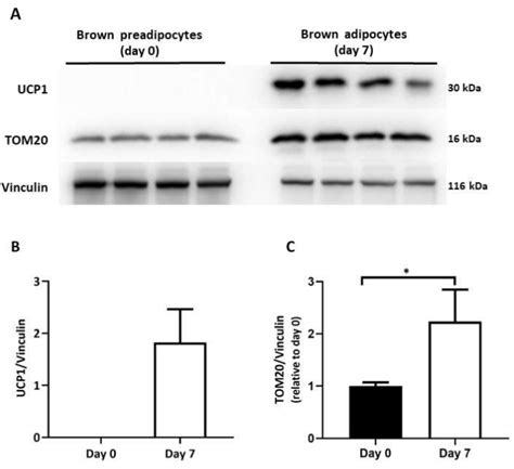 Differentiation And Imaging Of Brown Adipocytes From The Stromal Vascular Fraction Of