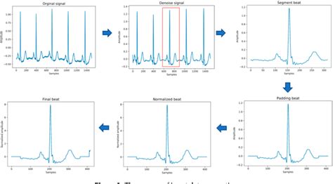 Figure 3 From A Deep Learning Approach To Ecg Classification Based On