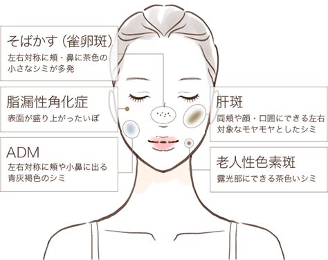シミくすみ柏の葉皮ふ科柏の葉キャンパスクスミのない肌