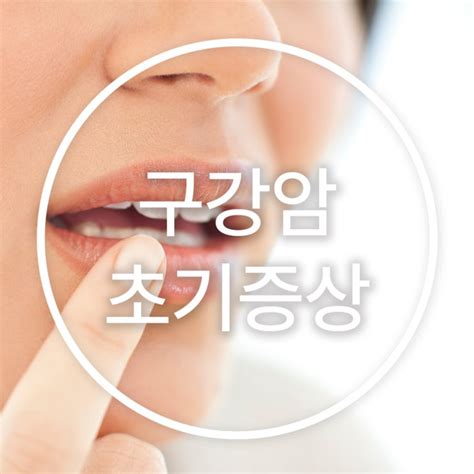 구강암 초기증상 구강암 증상 알아보기 네이버 블로그