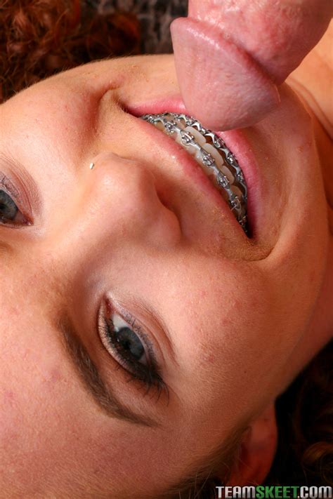 Curly Headed Teen Eli Luxx Gets Braces Blasted With Cumshot After Couch