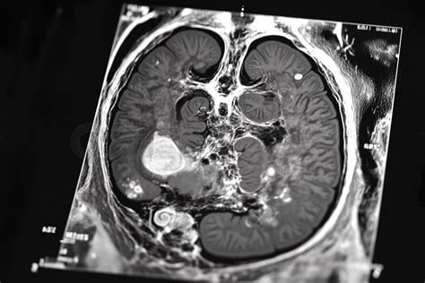 医学影像ai数字艺术 肝现代黑白灰风格大脑mri扫描医学影像 Ai图片免费下载 Png格式 1344像素 编号71439957 千图网
