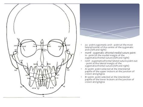 Cephalometric Tracing Program Souprewards