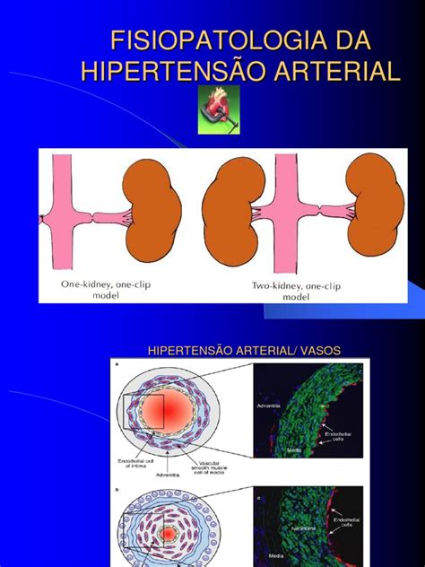Fisiopatologia Da Hipertensão Arterial Pdf Hipertensão Rtt