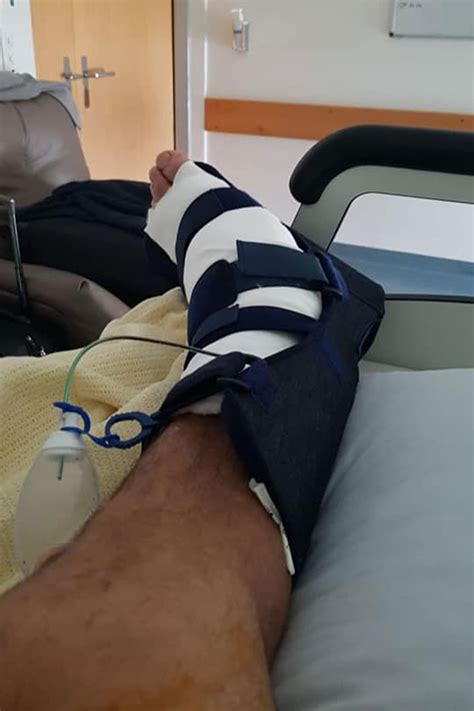 Gabriel Batistuta Pasó Por El Quirófano Cómo Es La Prótesis Que
