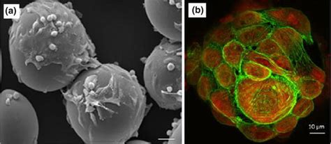 Development Of Microspheres For Biomedical Applications A Review Pmc